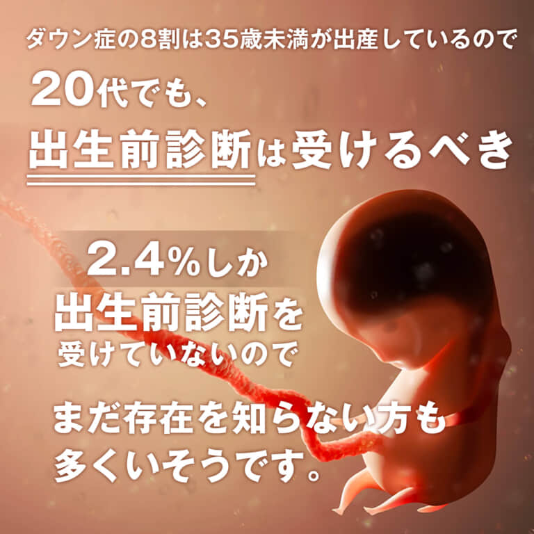 【2025年最新】NIPT陰性だったのに20代で2回もダウン症出産 | 東京・ミネルバクリニック